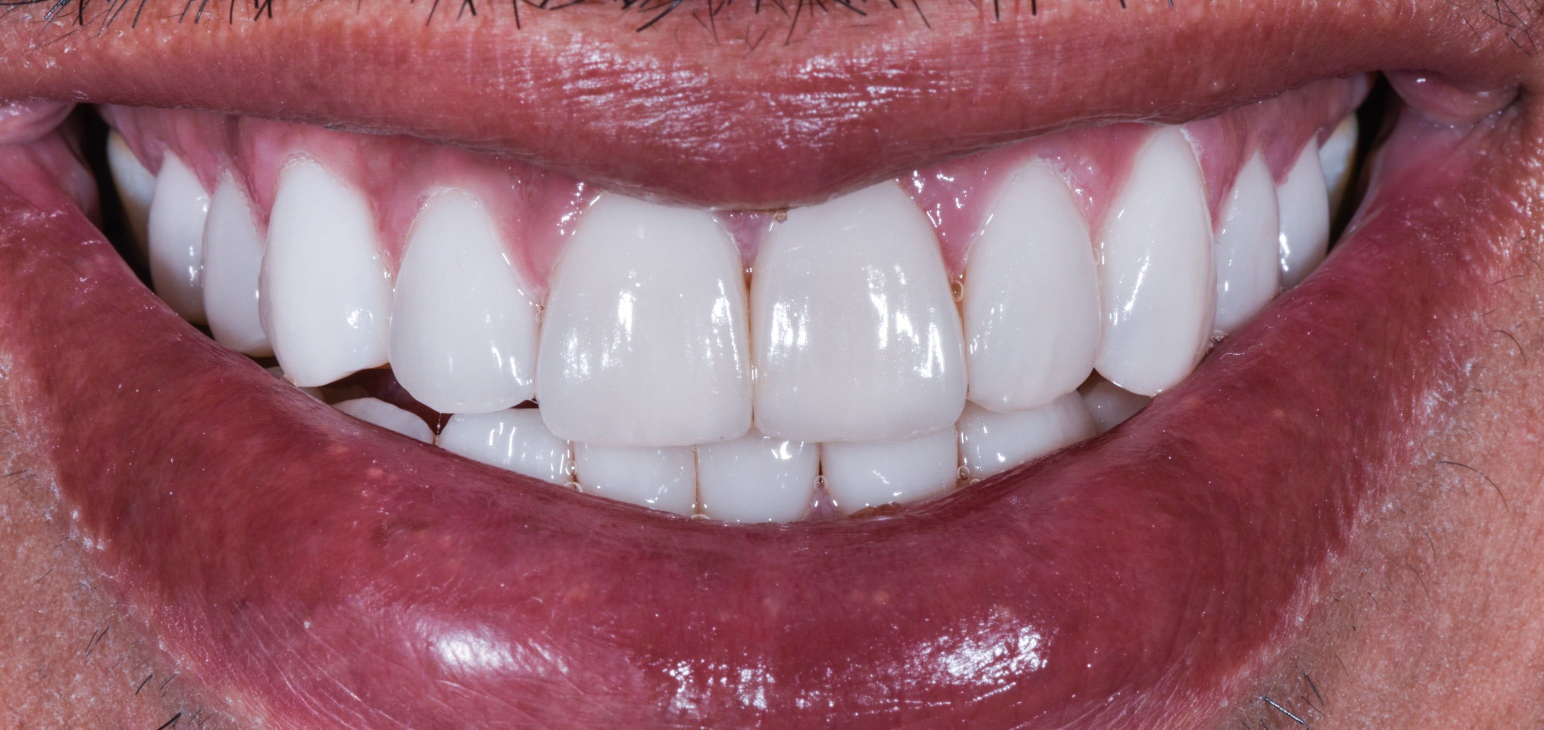 Dr. Mohammad Al Rifai – Al Ain, UAE